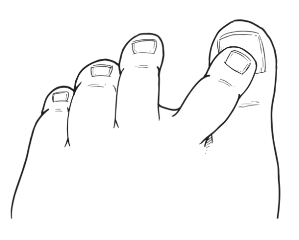 Podiatry Services | Podiatrist, Foot Doctor, Canton, MI 48187, Garden ...